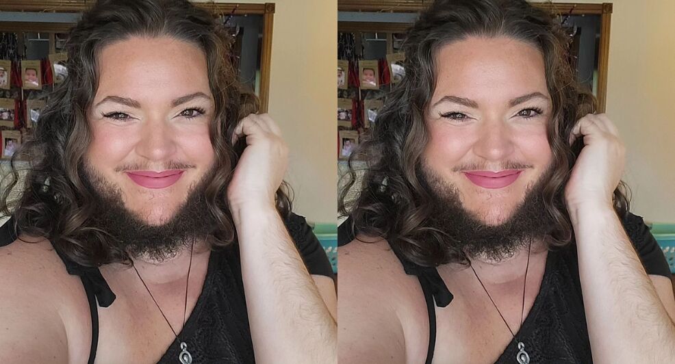 Vrouw gaat met een baard door het leven: 'Ik hou ervan' | FEM FEM