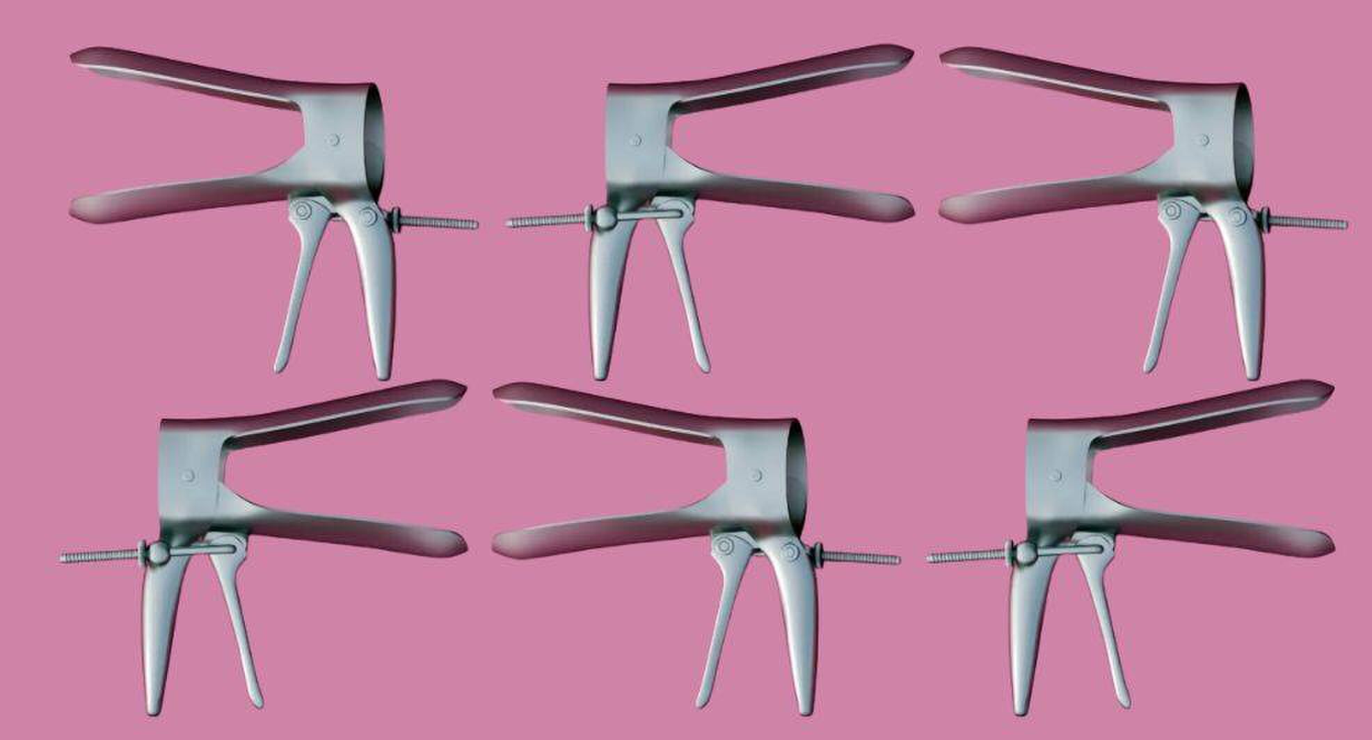 Nieuwe ‘eendenbek’ maakt gynaecologisch onderzoek eindelijk minder ...