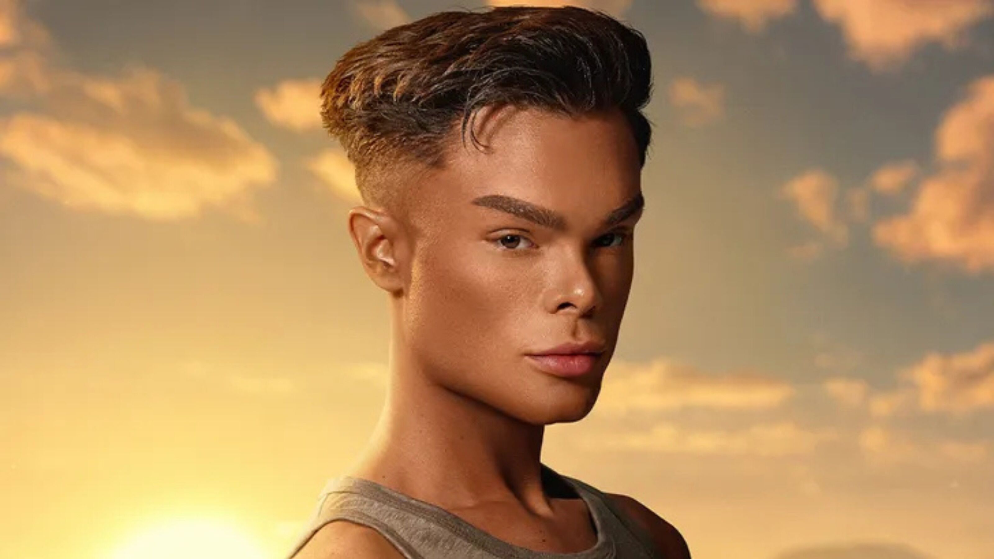 Melle uit Echte Jongens op Safari verwijdert fillers